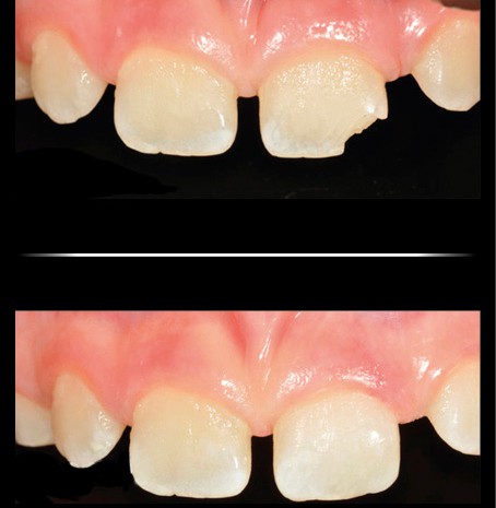 Portfolios Archivo - Dentista Villanueva del Pardillo